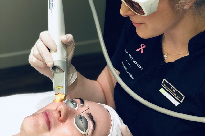 Benign and unwanted pigmentation got you down? Laser Excel V and IPL ...